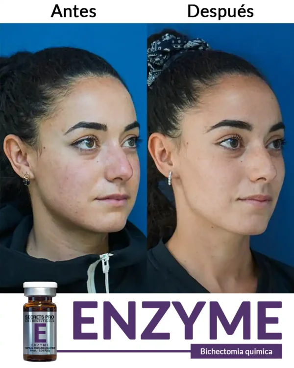 Enzyme - Secrets Pro